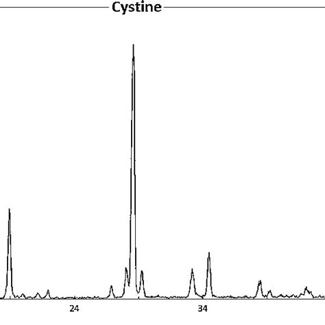 X Ray Diffraction Pattern Of Calcium Oxalate Stone Sample MP Download Scientific Diagram