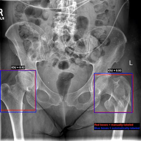 Manual Versus Automated Bounding Box Placement On An Image From Our Download Scientific Diagram