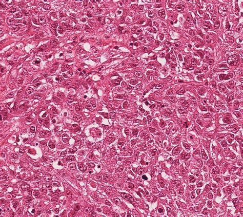 A11 Object Detection Dataset And Pre Trained Model By Mitosis