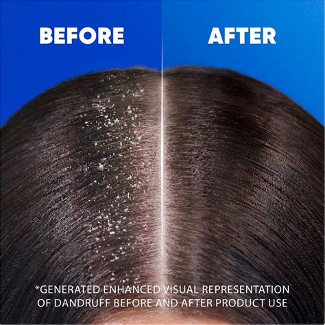 Head And Shoulders Classic Clean Anti Dandruff Shampoo Uk