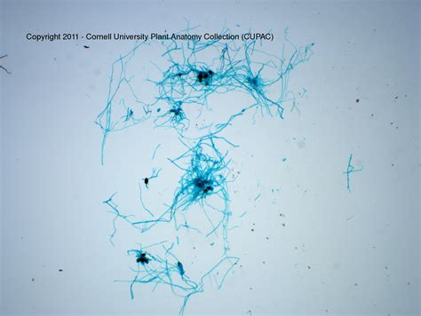 Moss Protonema Labeled