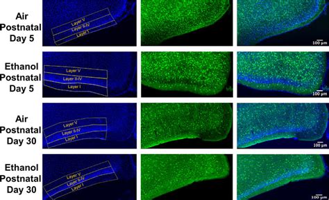 Sample Images From Ventral Retrosplenial Cortex Of Control