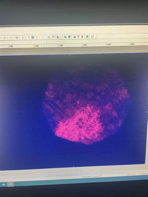 Microscope Image Doesnt Display Entire Field Of View When I Switch To Fluorescent Bulb