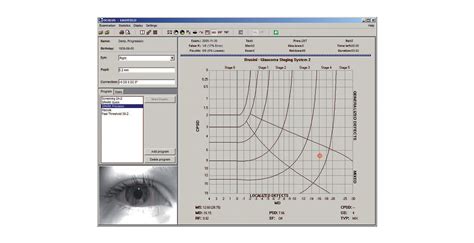 Oculus Easyfield® C Compact Perimeter