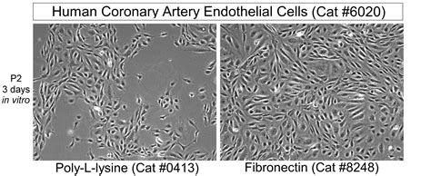 Poly Mononuclear Cells