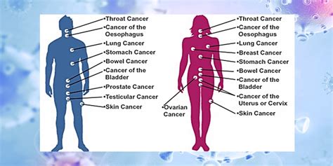 Types Of Cancer Target Radiology