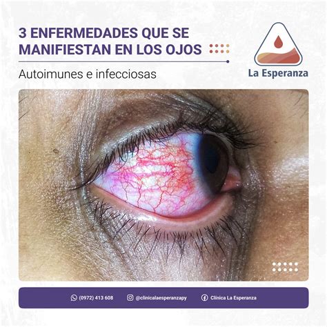 Clínica Los Ojos Pueden Ser Indicadores Clave De Diversas