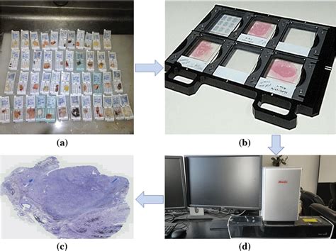 The Workflow Of Whole Slide Imaging A Histopathological Tissues From Download Scientific