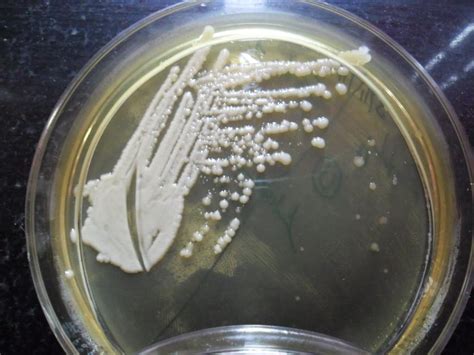 Isolation Of A Rhizobium From Urad Root Nodules On Yeast Extract Download Scientific Diagram