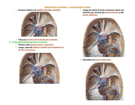 Anatomía Del Tercer Nervio Craneal