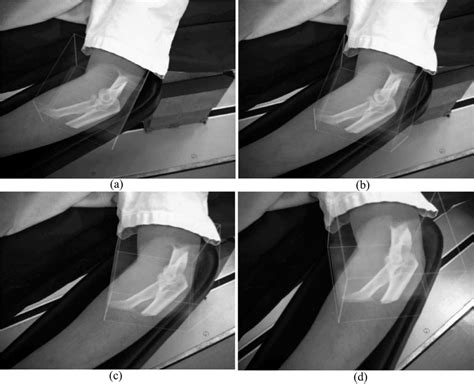 Time Sequentially Generated Images In The Data Fusion Display The