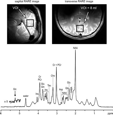 Figure 1 From Methodology Of 1 H Nmr Spectroscopy Of The Human Brain At