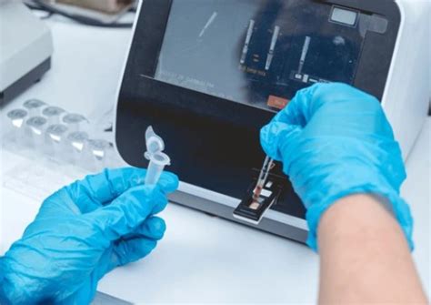 Cytokine Detection Elisa Kits Creative Diagnostics