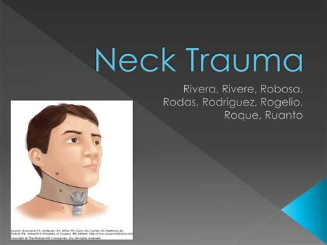PPT Neck Trauma PowerPoint Presentation Free Download ID