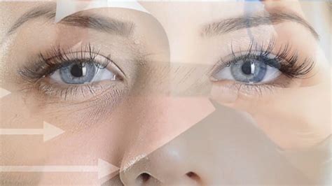 بهترین و جدیدترین کرم برای ازبین بردن چین و چروک دور چشم نماشا