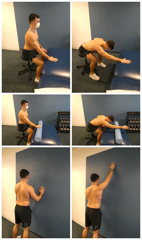 Acromioclavicular Joint Injuries Effective Rehabilitation Oajsm