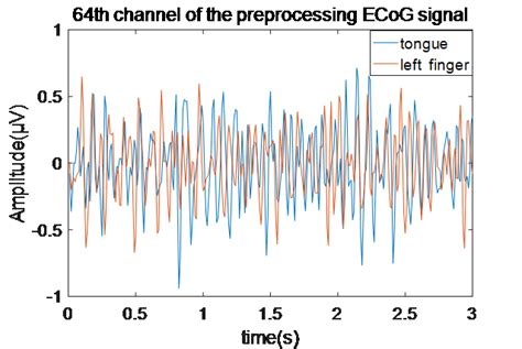 the original ecog signal and the preprocessing ecog signal download scientific diagram