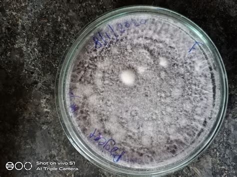 Questions With Answers In BACTERIAL TYPING TECHNIQUES Science Topic