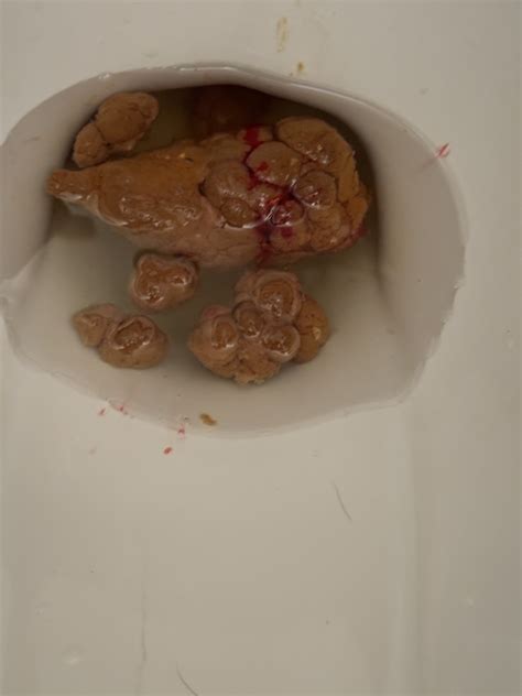 Morning Poop Caca Matinal En Anglais