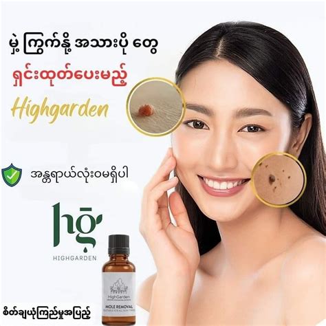 မှဲ့ ကြွက်နို့ အသားပို ဖျက်ချင်သူတိုင်းအတွက် နတ်ဆေးသဖွယ်