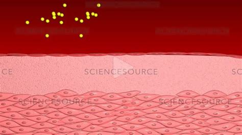Atheroma Formation Stock Video Science Source Images
