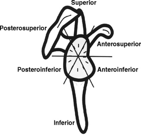 Gh Injuries Part 1 Labral Tears Devyn Exm 2 Flashcards Quizlet