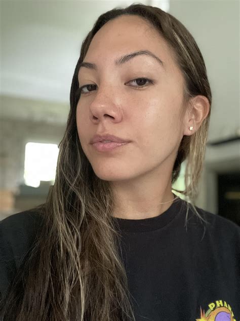 [before And After] After Years Of Battling Against Active Acne I Can Surely Say That Is Under