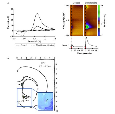 Dopamine Release As Measured By Fscv In The Nucleus Accumbens During