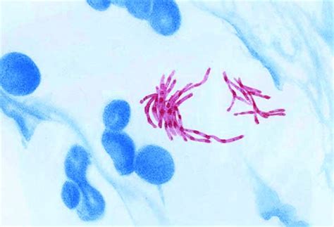 认识结核分枝杆菌 细胞壁 世界 菌落
