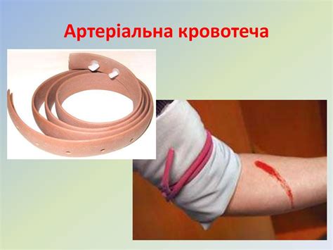 Основи медичних знань і допомоги Застосування засобів з надання першої допомоги у надзвичайних