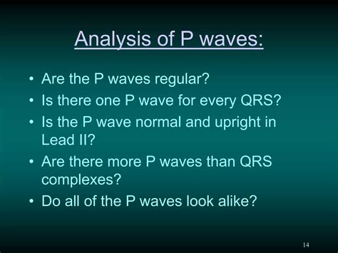An Overview Of Paediatric Ecg Pdf
