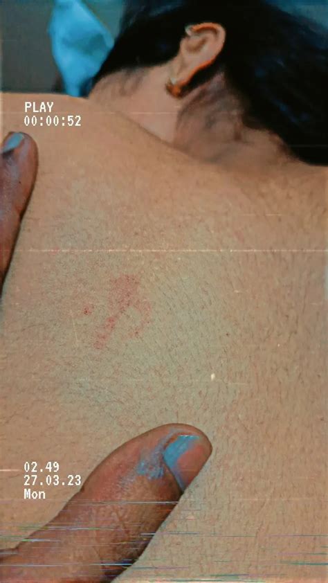 Love Bite 1 Nude Pics Xhamster