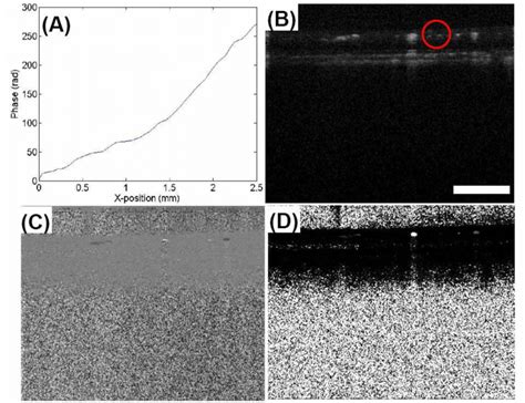 Final Results After Applying The Motion Compensation Method To Download Scientific Diagram