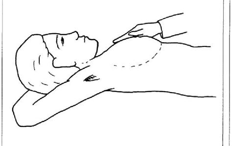 Figure From Clinical Examination Of The Breast Semantic Scholar