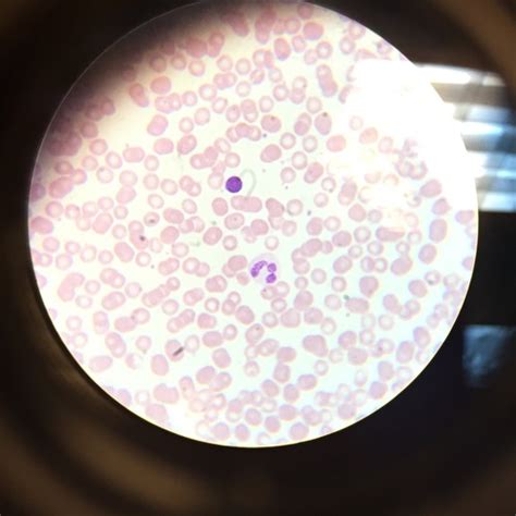 Micro Lab Exam Microscope Flashcards Quizlet