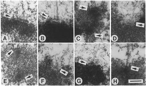 Kinetochore Morphology In Anti Cenp C Injected Cells 4 Kinetochore