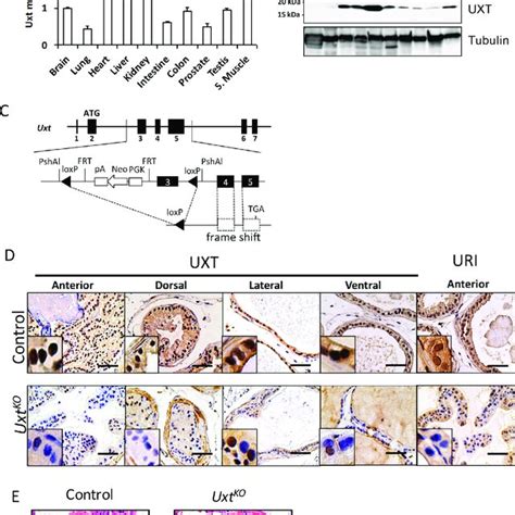 Uxt Ablation In The Mouse Prostate Resulted In Pin Different Mouse