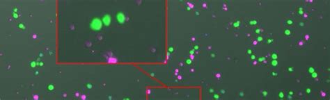 City Of Hope Researchers Discover Human Ilc2 Cells Donna Morelli