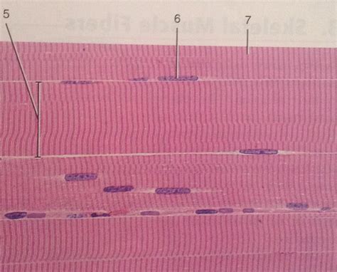 Skeletal Muscle Tissue Labeled
