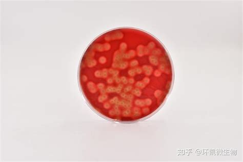 血琼脂平板培养基 知乎