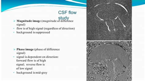 Csf Production Dynamics And Physiology Pptx