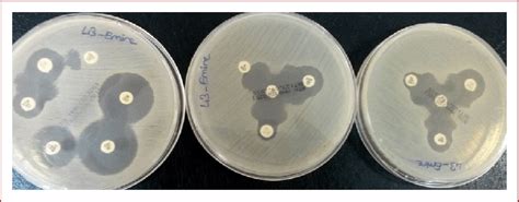 Antibiogram Image Of Esbl Producing Li Isolate At The End Of 18
