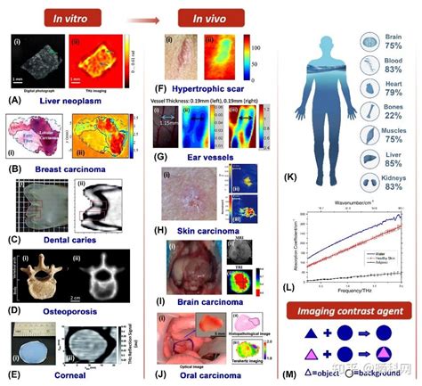 四川大学材料学院黄婉霞、施奇武团队在太赫兹生物成像技术领域取得成果 知乎