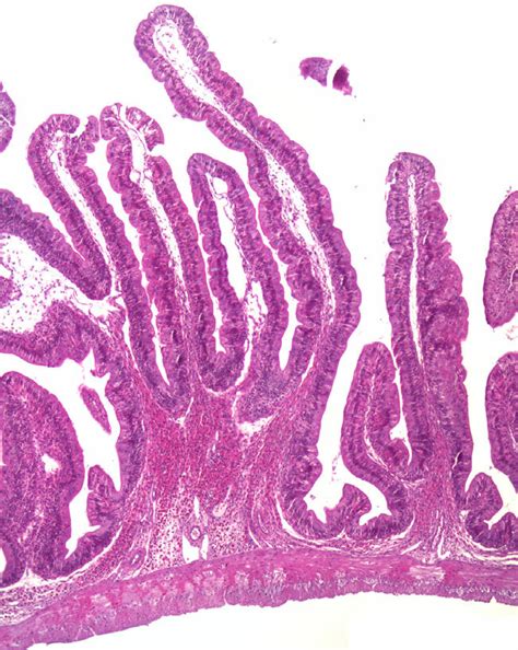 A Representative Image Showing The Bifurcation Of Intestinal Mucosal