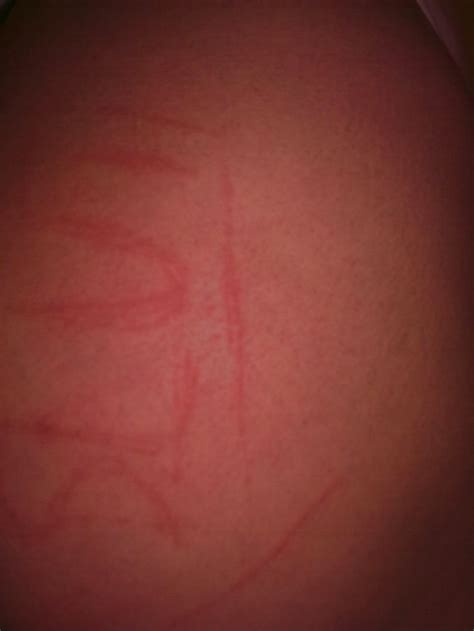 Scottish Slut Porn Pictures Xxx Photos Sex Images 179517 Pictoa