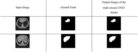 Segmented Ct Images From Triple Models Download Scientific Diagram