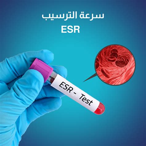Esr مختبرات أنيس الخير