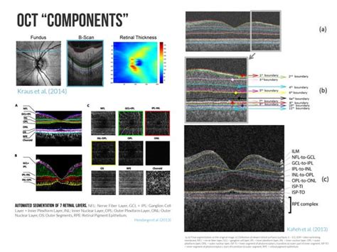 shallow introduction for deep learning retinal image analysis pdf