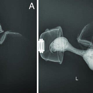 A Whole Body Radiographs Of A Year Old Unknown Sex Lineolated Download Scientific Diagram