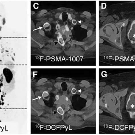 Chemical Structures Of 177 Lu Psma 617 And 177 Lu Psma Iandt Download